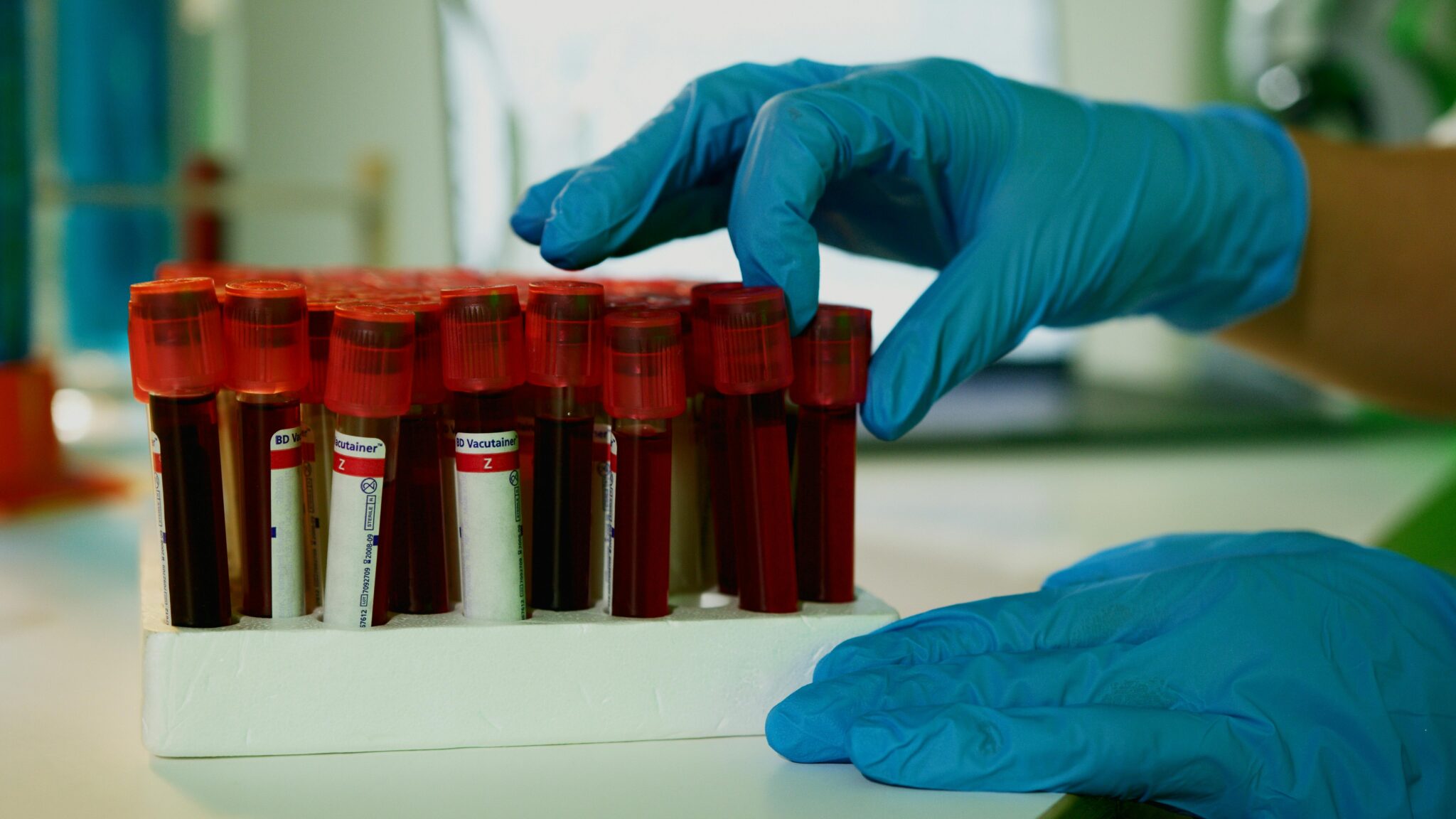 What Does a Positive Faecal Occult Blood Test Result Mean? - Clinic for ...